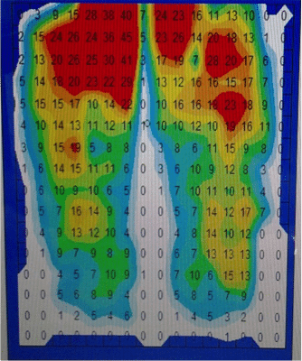 Pressure Ulcer Prevention Webinar - Independent Living Centre